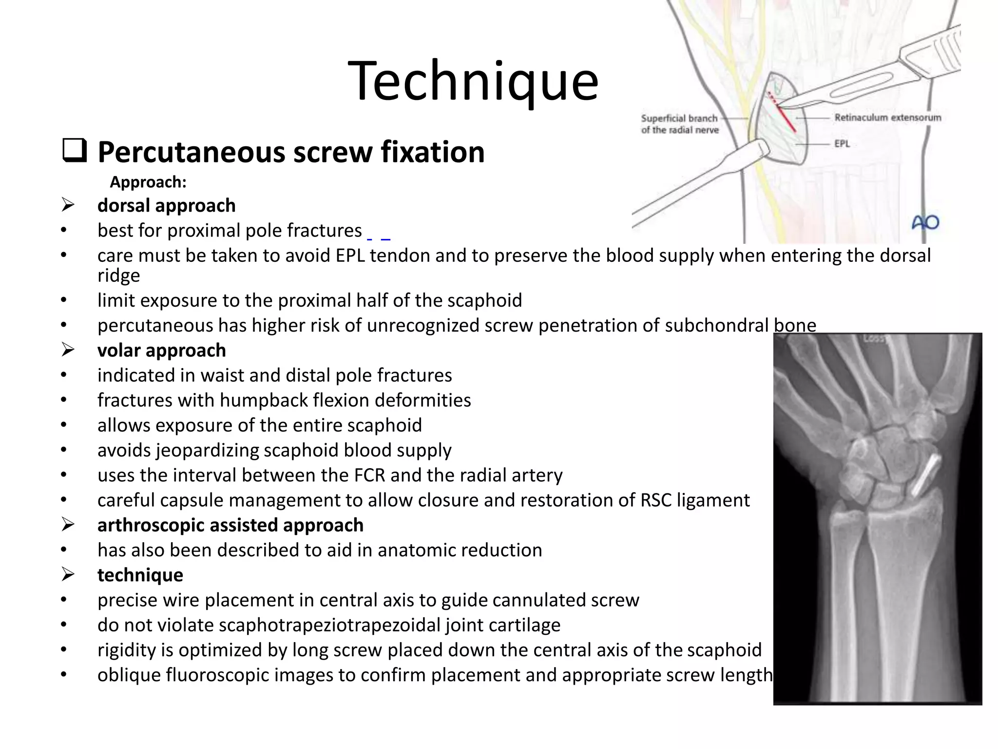 Open Reduction of carpal bone fractures | PPT