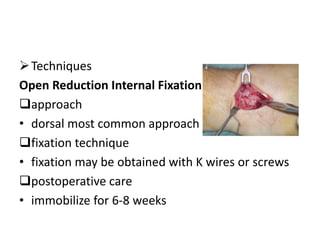 Open Reduction of carpal bone fractures | PPTX