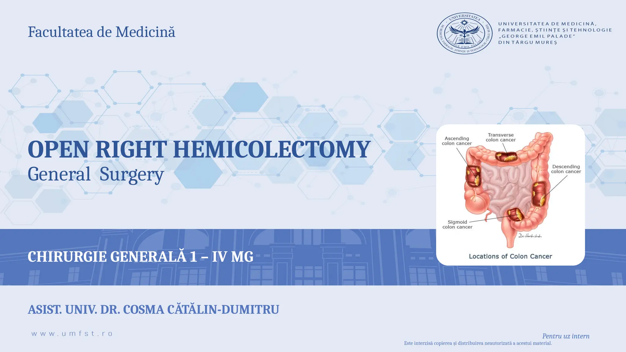 OPEN RIGHT HEMICOLECTOMY - General Surgery Course.pptx