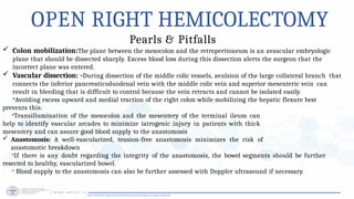 OPEN RIGHT HEMICOLECTOMY - General Surgery Course.pptx