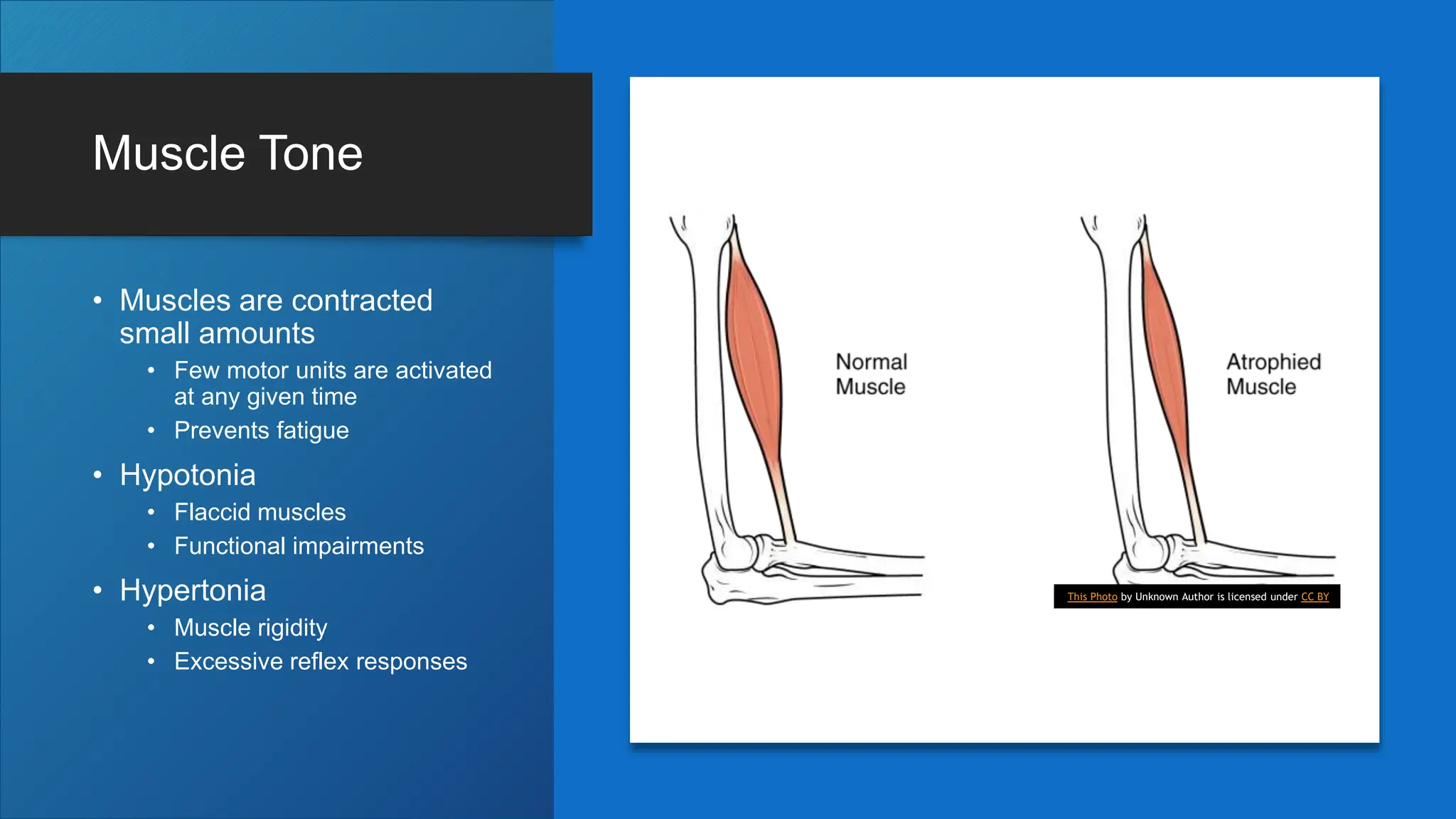 Anatomy and Physiology 2e - Chapter 10: Muscle Tissue | PPTX