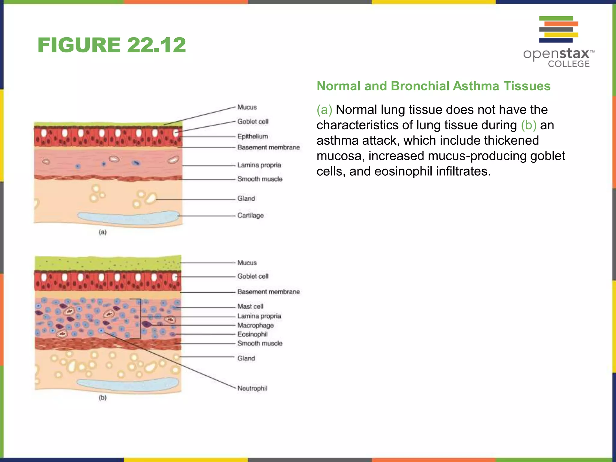 Open Stax Anatomy & Physiology Ch 22 | PPTX
