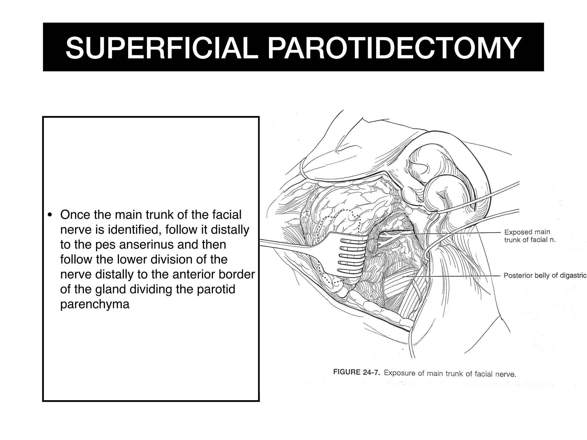 Parotidectomy superficial orlhns technique | PDF