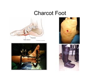 Comprehensive Diabetic Foot Examination | PDF