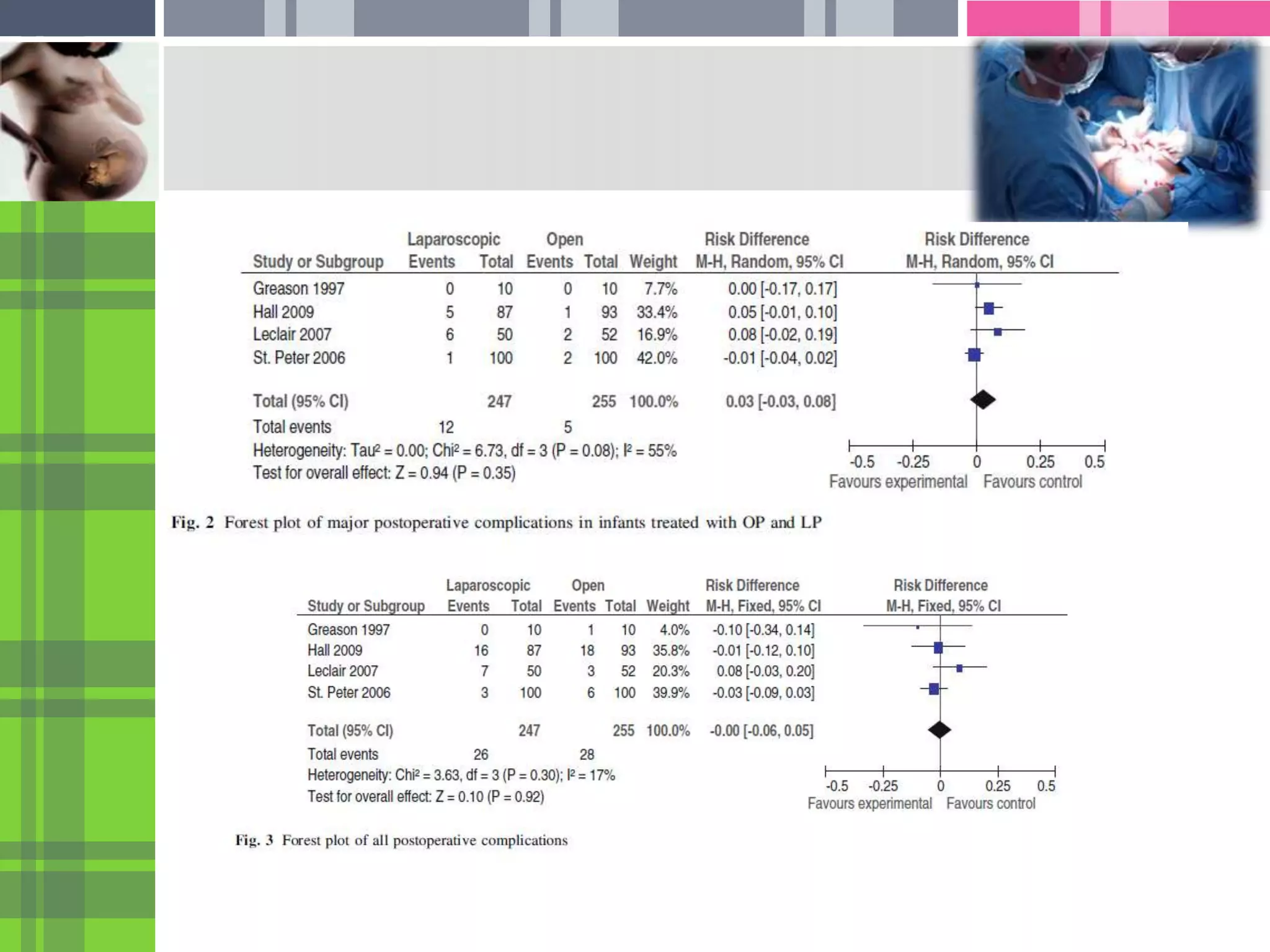 Stenosis Hipertropic pylorus Open versus laparoscopic pyloromyotomy | PPTX