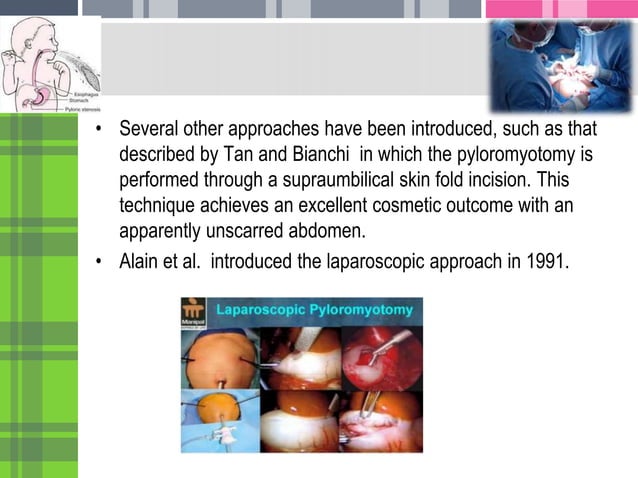 Stenosis Hipertropic pylorus Open versus laparoscopic pyloromyotomy | PPT