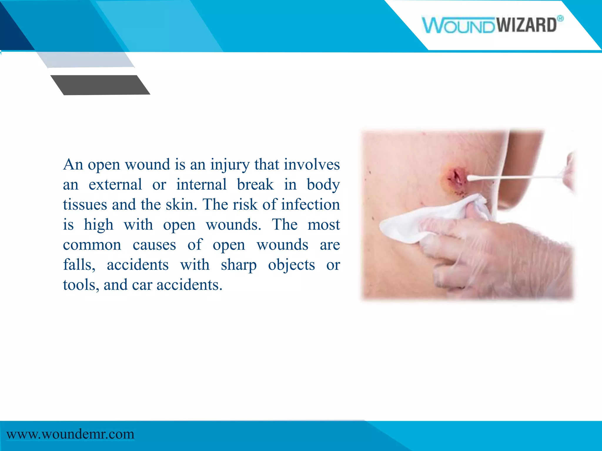 Open wounds – types and treatment options | PPSX