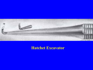 Ordinary Hatchet Excavator