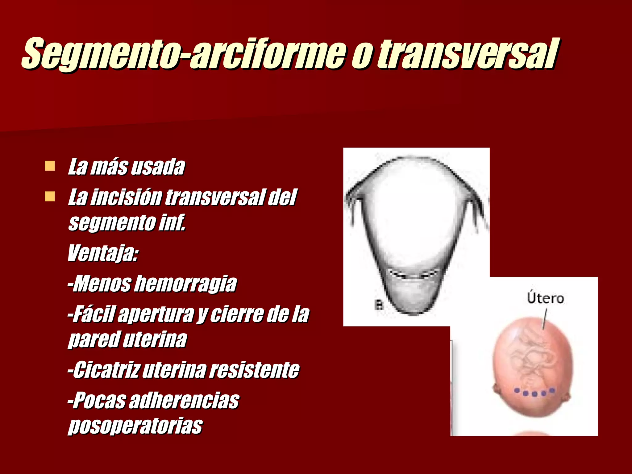 OPERACION CESAREA E HISTERECTOMIA OBSTETRICA | PPT
