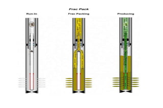 Operasi produksi sand control | PPTX