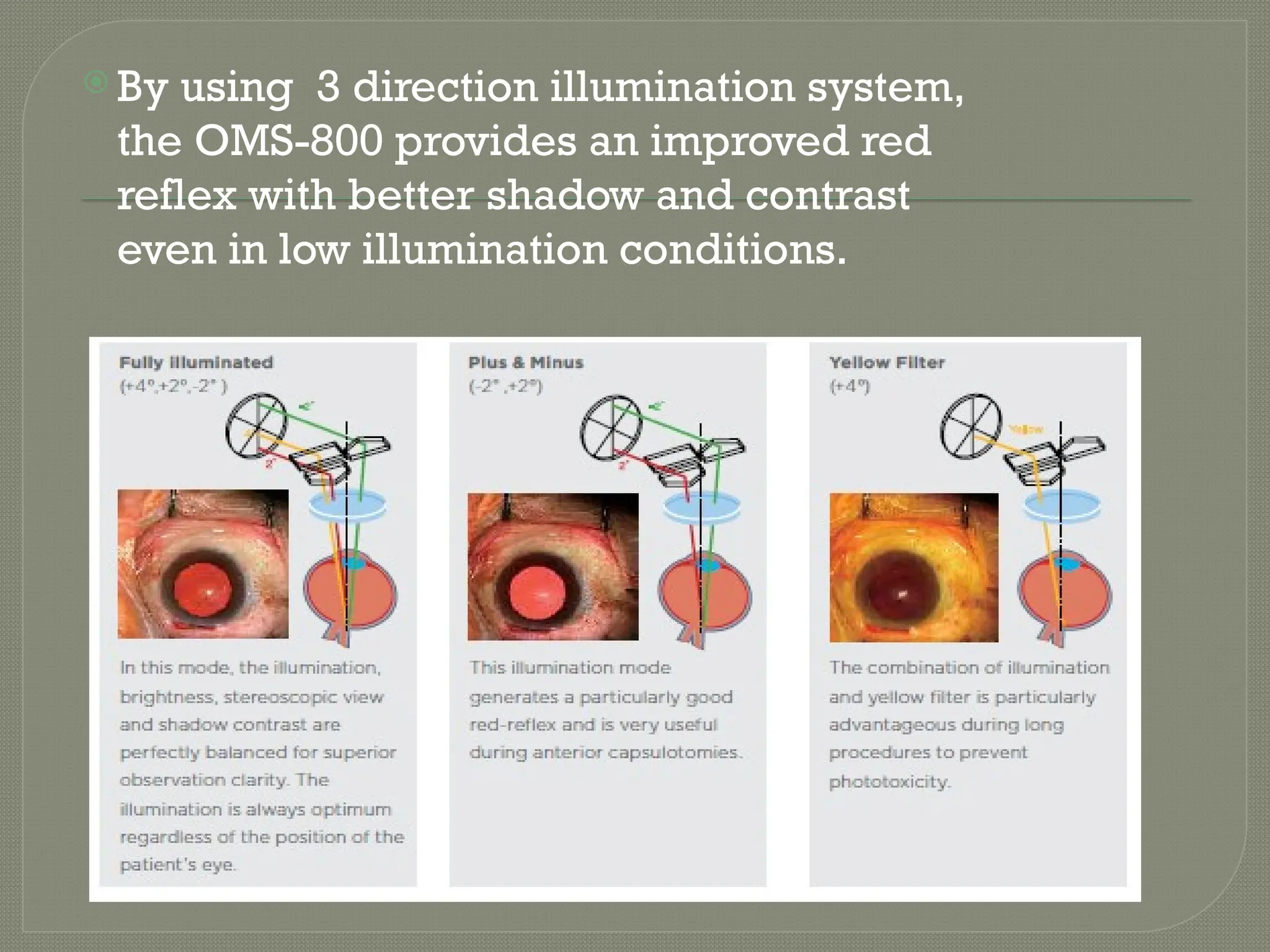 OPERATING MICROSCOPE in ophthalmology ot.pptx