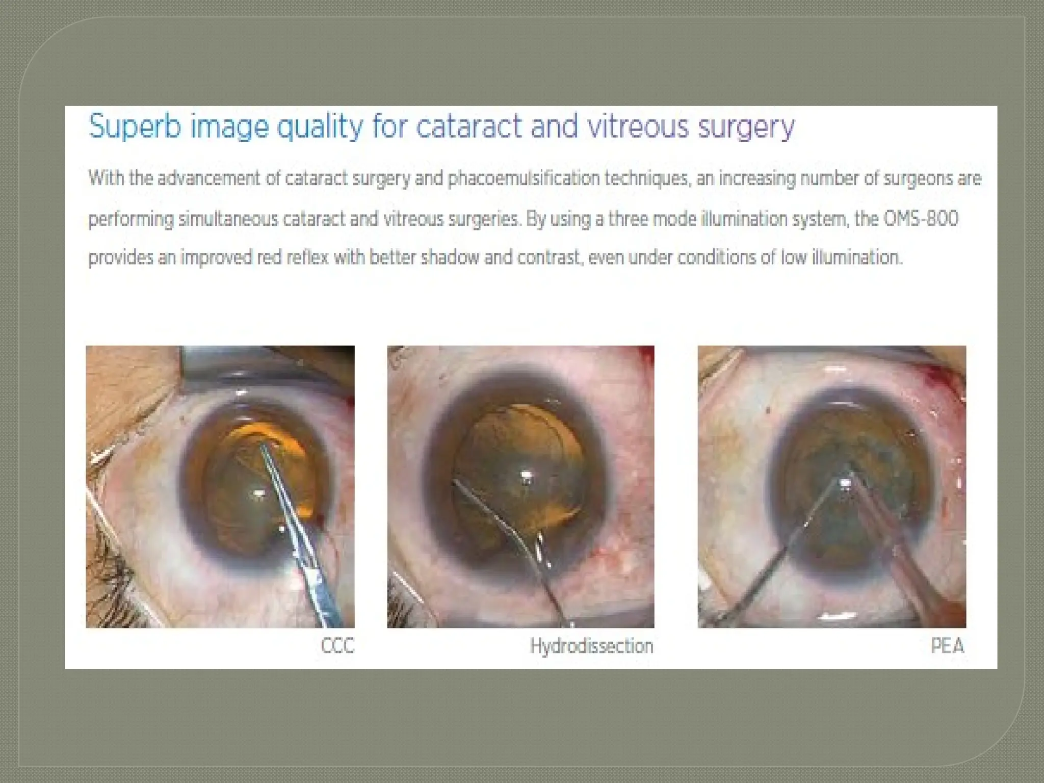 OPERATING MICROSCOPE in ophthalmology ot.pptx