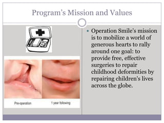 Operation Smile Globe Logo