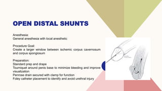 OPERATION TECHNIQUE about priaspsm in human | PPTX