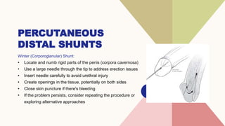 OPERATION TECHNIQUE about priaspsm in human | PPTX