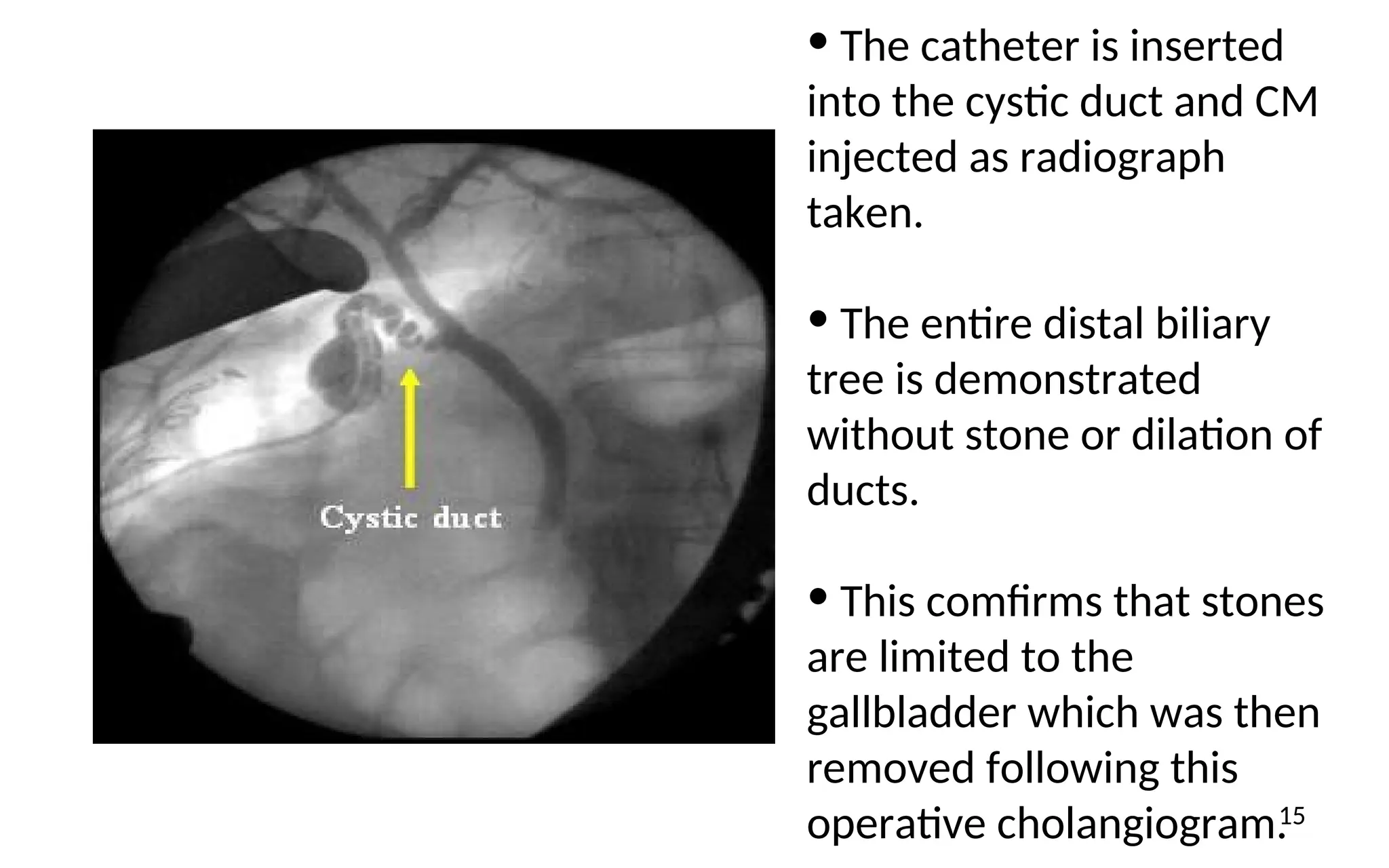 TOPIC MEDICAL IMAGING OPERATIVE CHOLANGIOGRAPHY.ppt