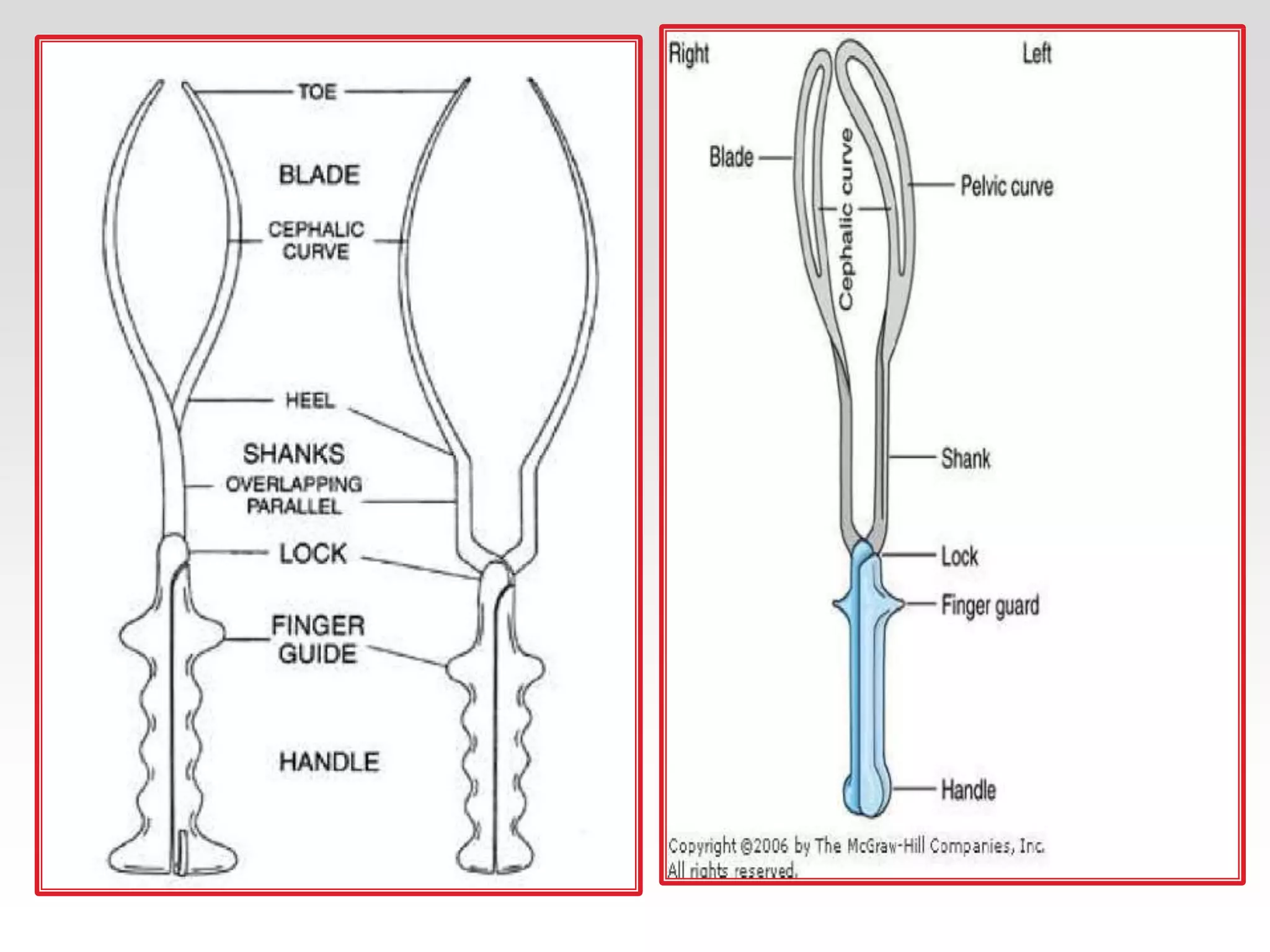 Operative Vaginal delivery | PPTX