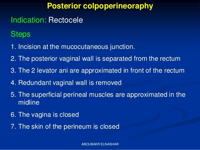 Operative gynecology