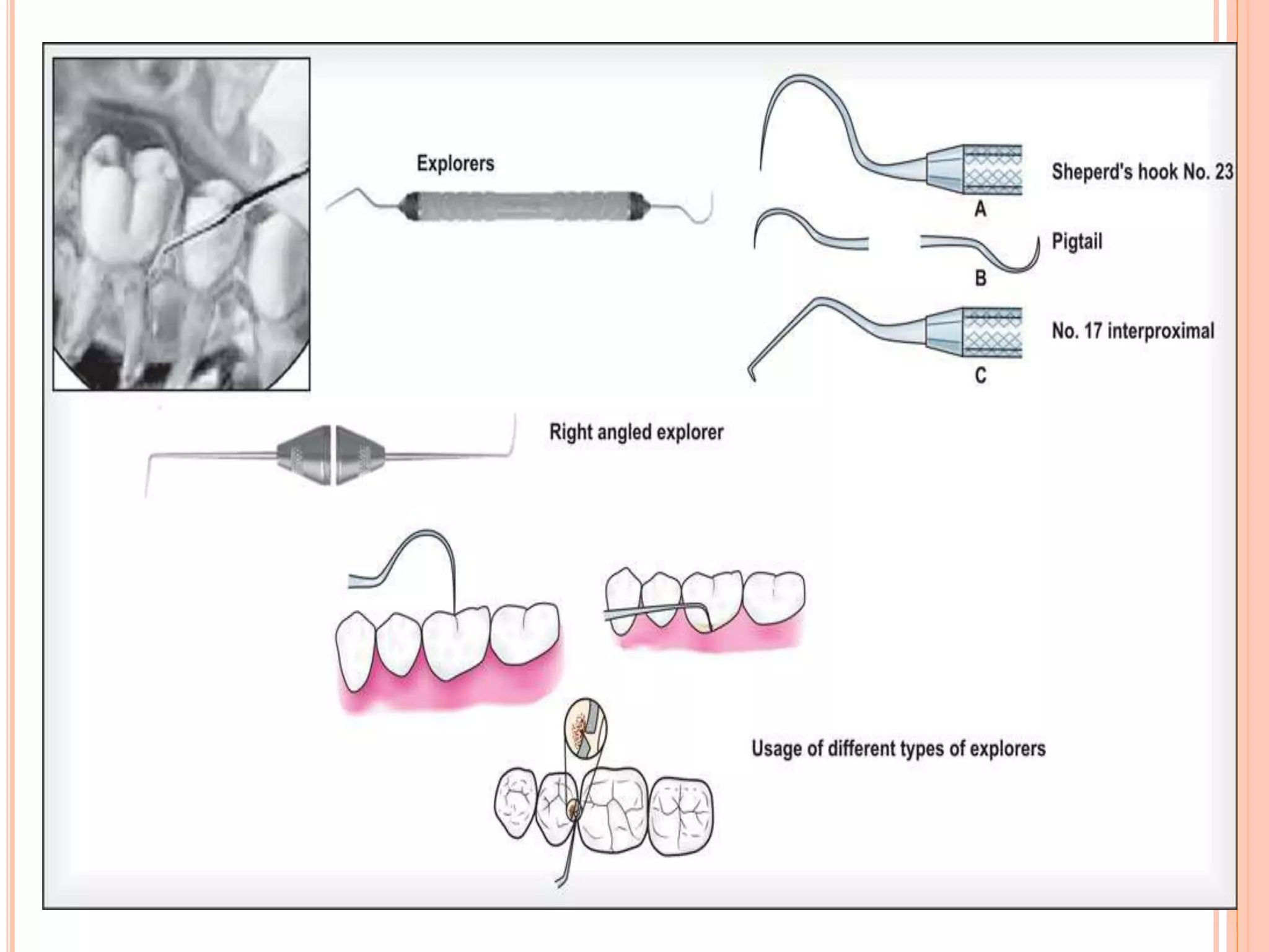 Operative hand instruments - DR SNEHA | PPTX