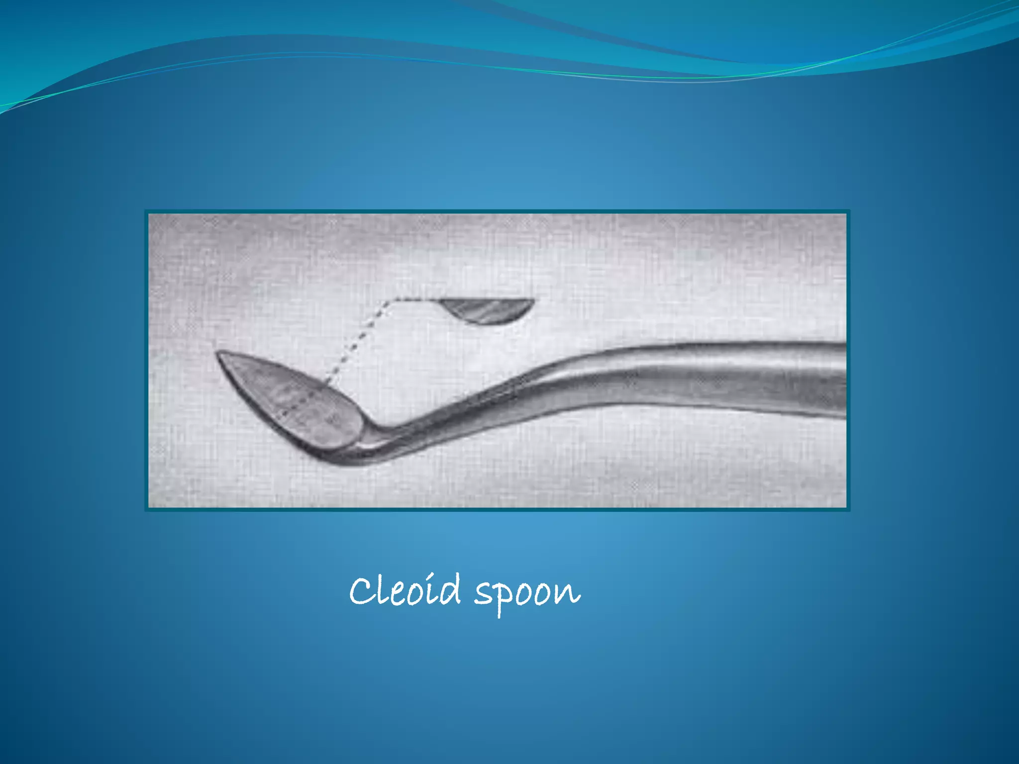 Operative instruments in Conservative Dentistry & Endodontics | PPTX