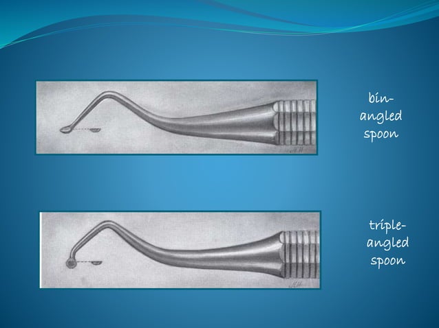 Operative instruments in Conservative Dentistry & Endodontics | PPTX ...
