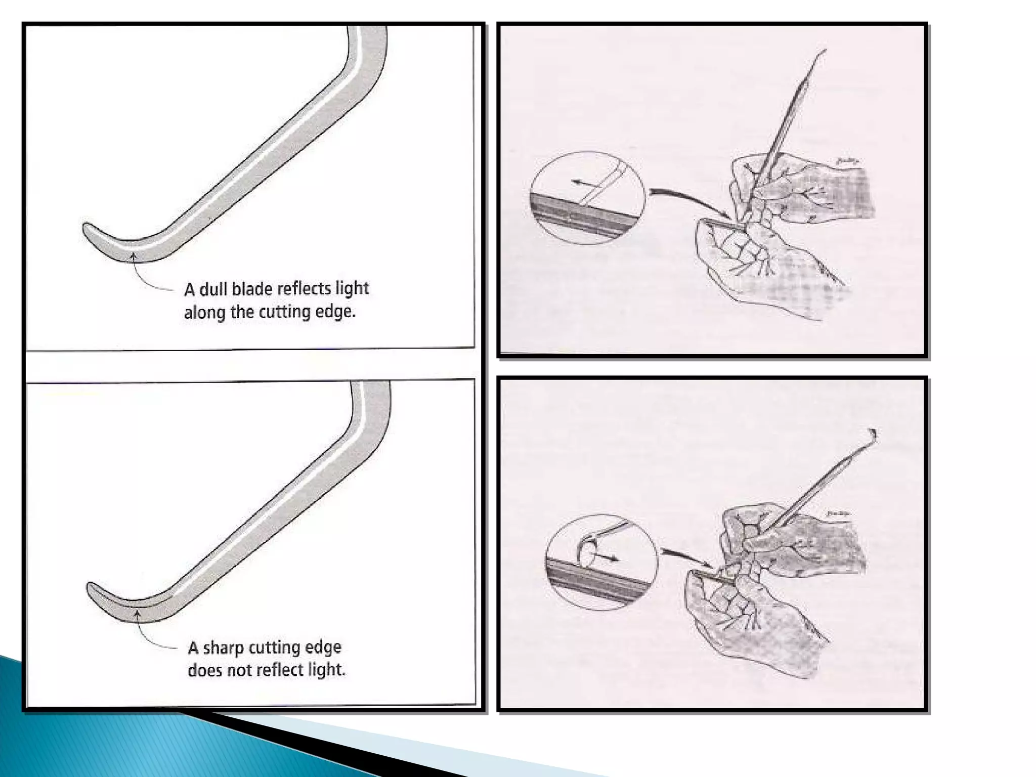 cutting instruments in operative dentistry by dr. jagadeesh kodityala | PPT