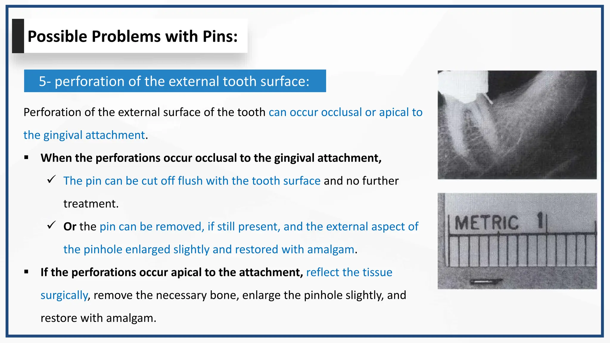 Operative Lec.12 Complex amalgum restorations.pdf