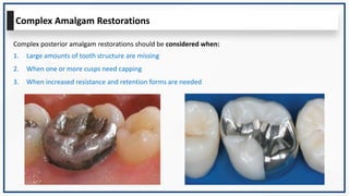 Operative Lec.12 Complex amalgum restorations.pdf