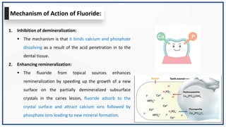 Operative Lec.15 Fluoride Releasing Materials.pdf
