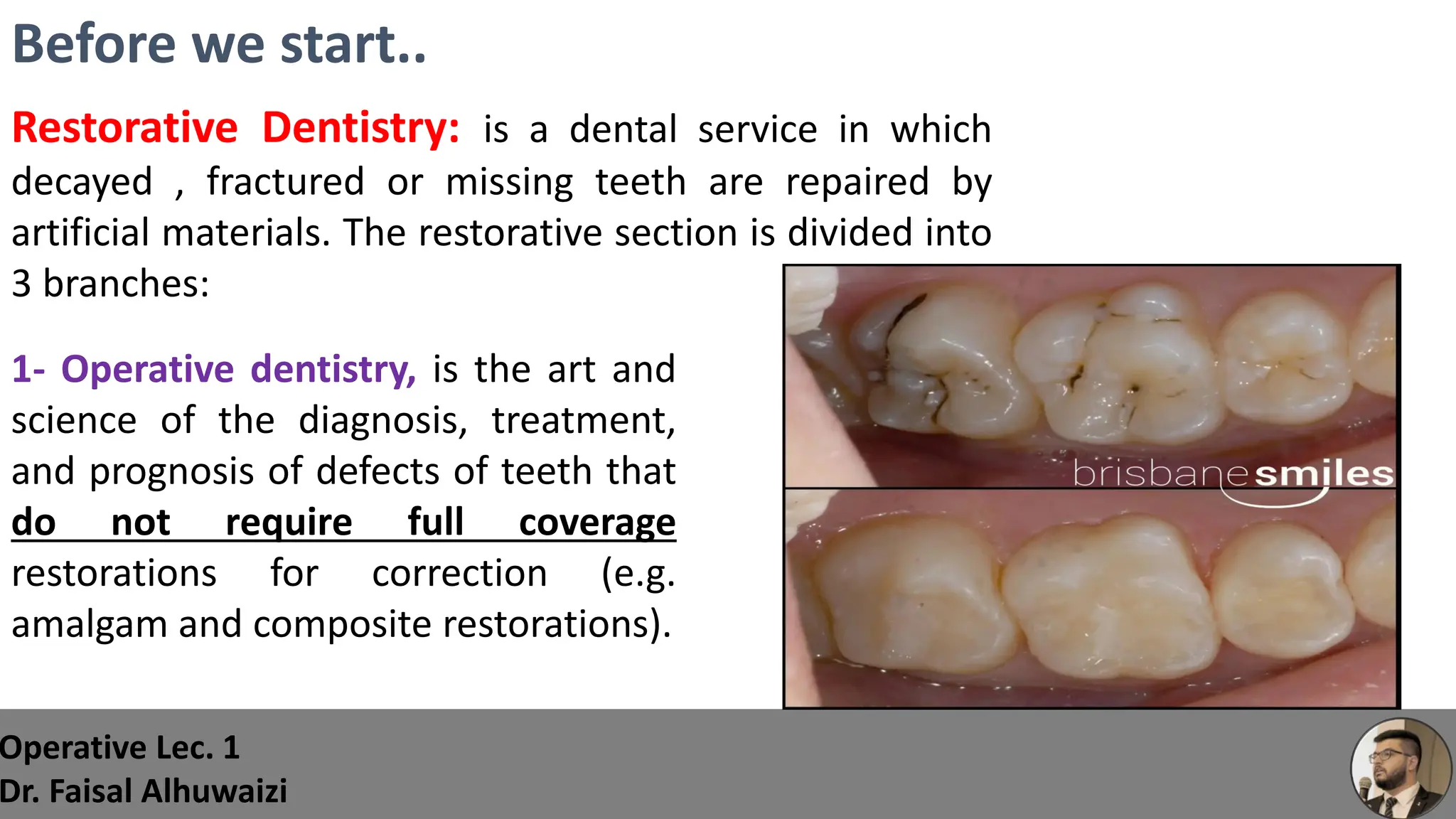 Operative1111111 Lec.1 Introduction..pdf