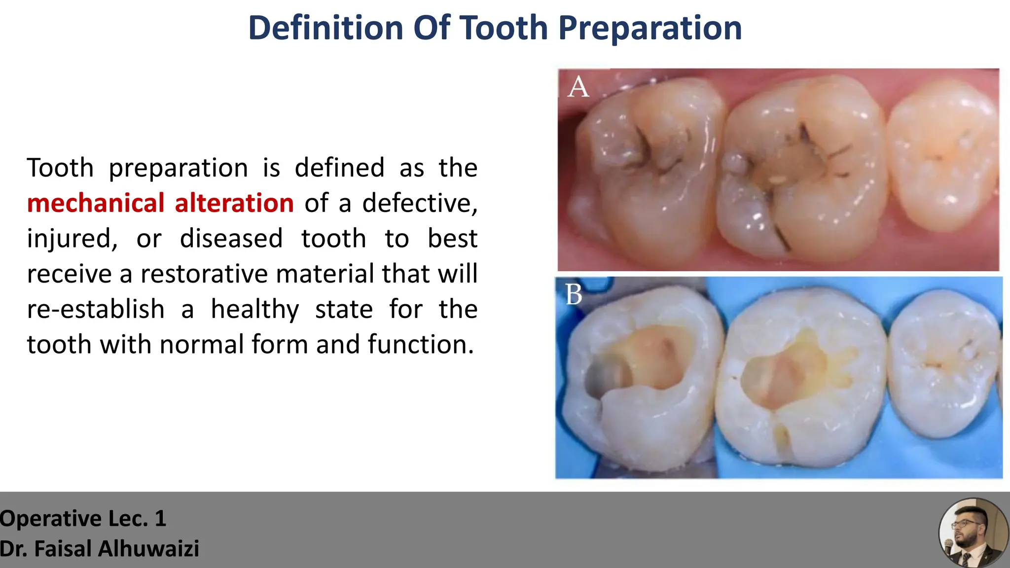 Operative1111111 Lec.1 Introduction..pdf