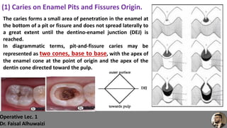 Operative1111111 Lec.1 Introduction..pdf