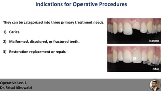 Operative1111111 Lec.1 Introduction..pdf