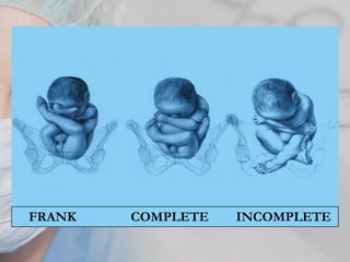 Operative obstetrics | PPTX