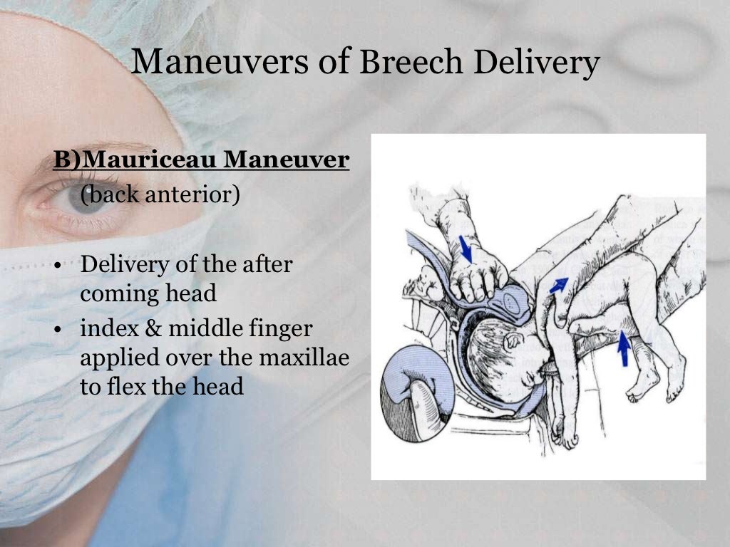 Operative obstetrics