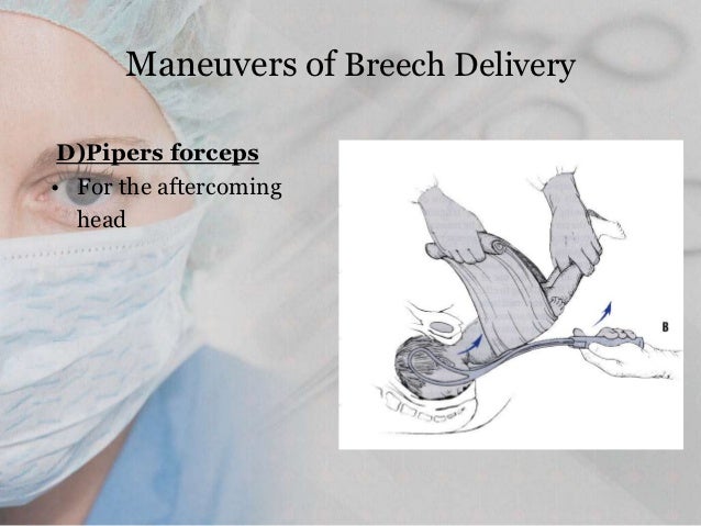 Operative obstetrics