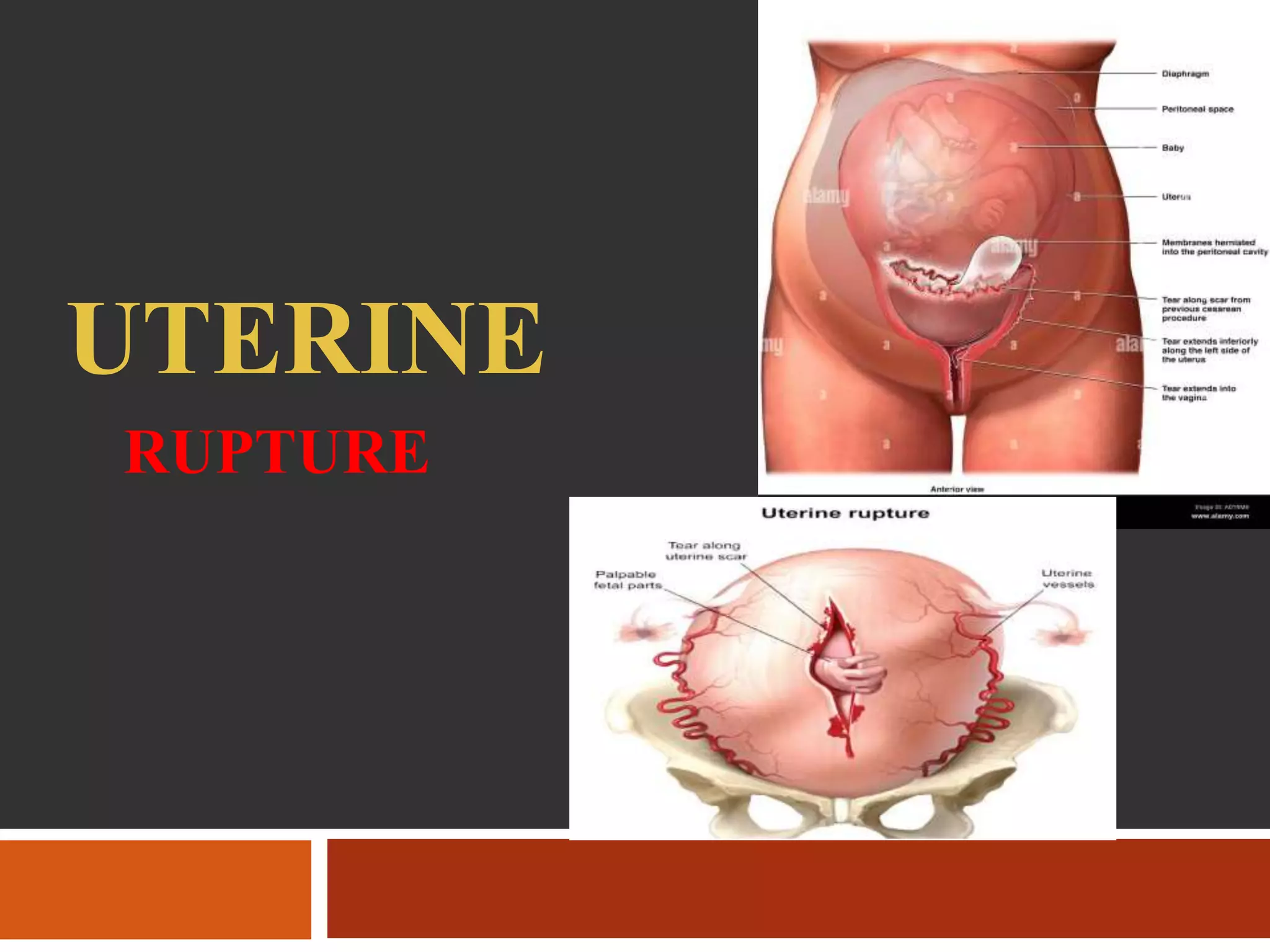 operative obstetrics emergency.pptx