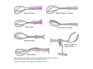 Obstetric Forceps Types