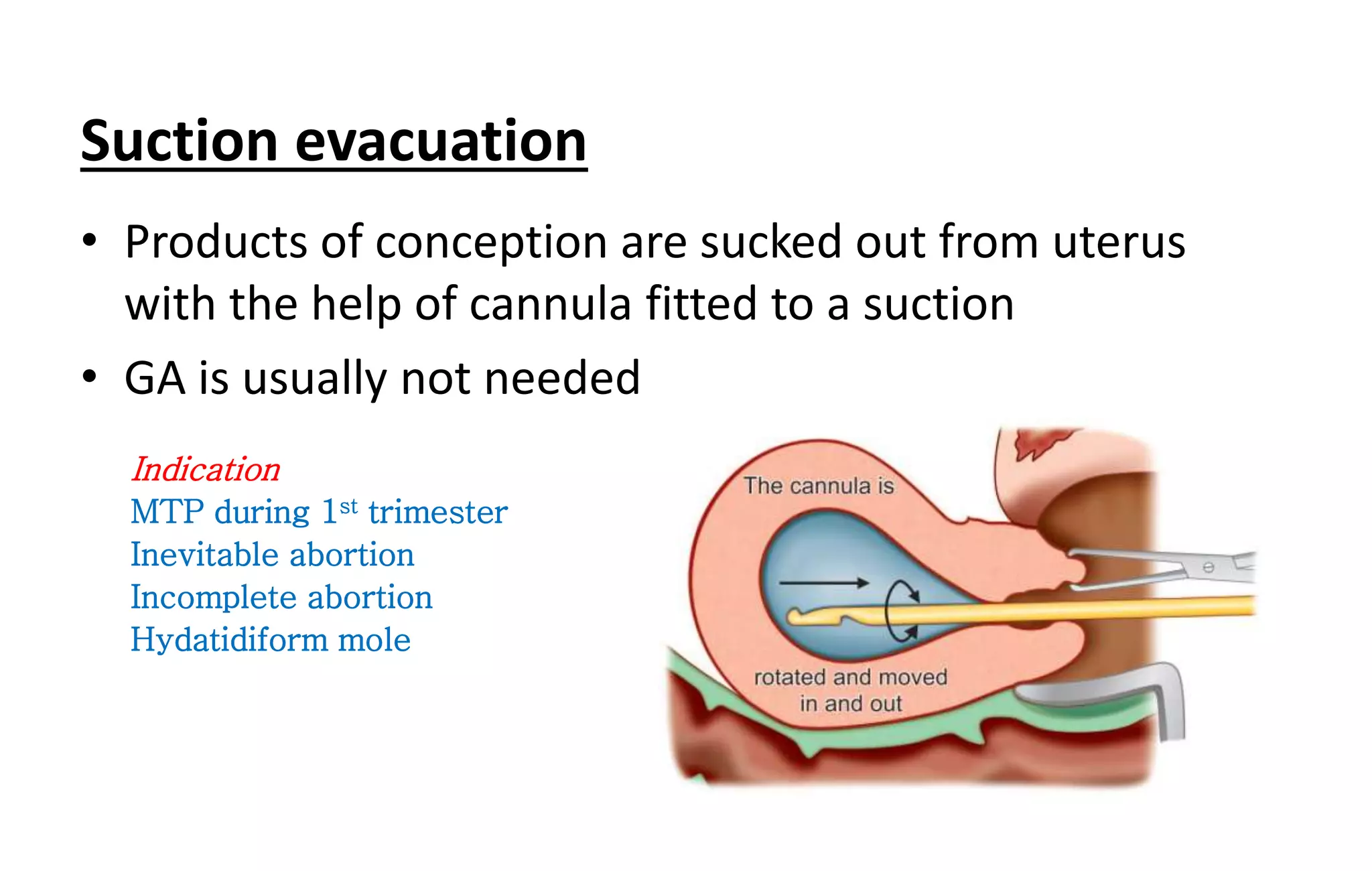 Operative procedure in obstetric | PPTX
