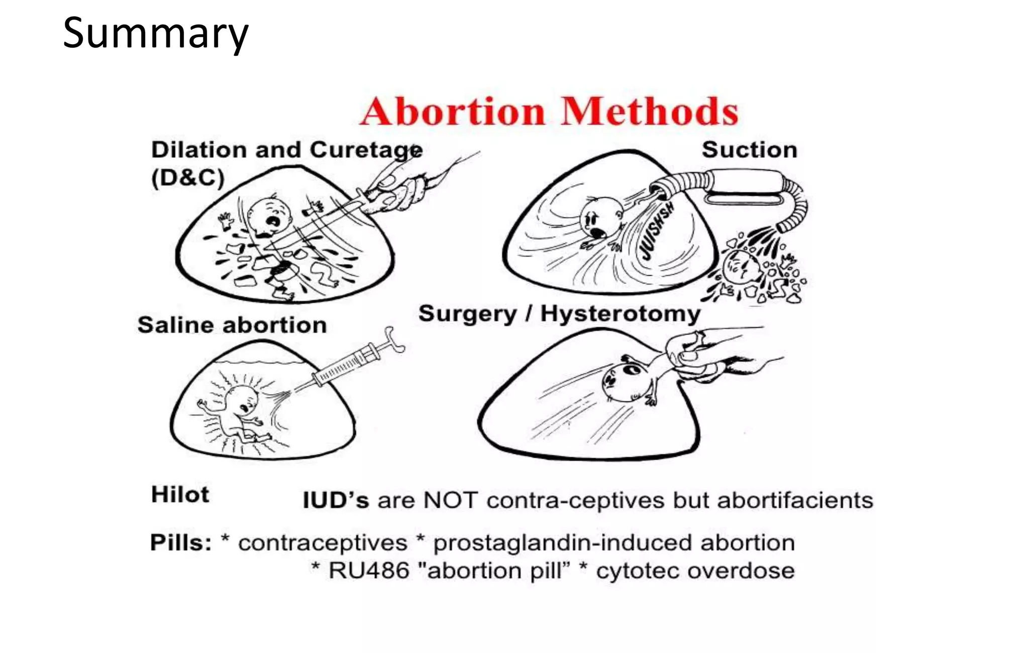 Operative procedure in obstetric | PPTX
