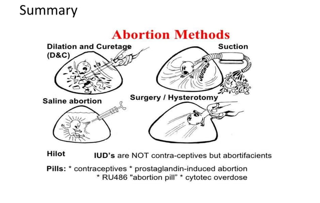 Operative procedure in obstetric | PPTX | Pregnancy | Reproductive Health