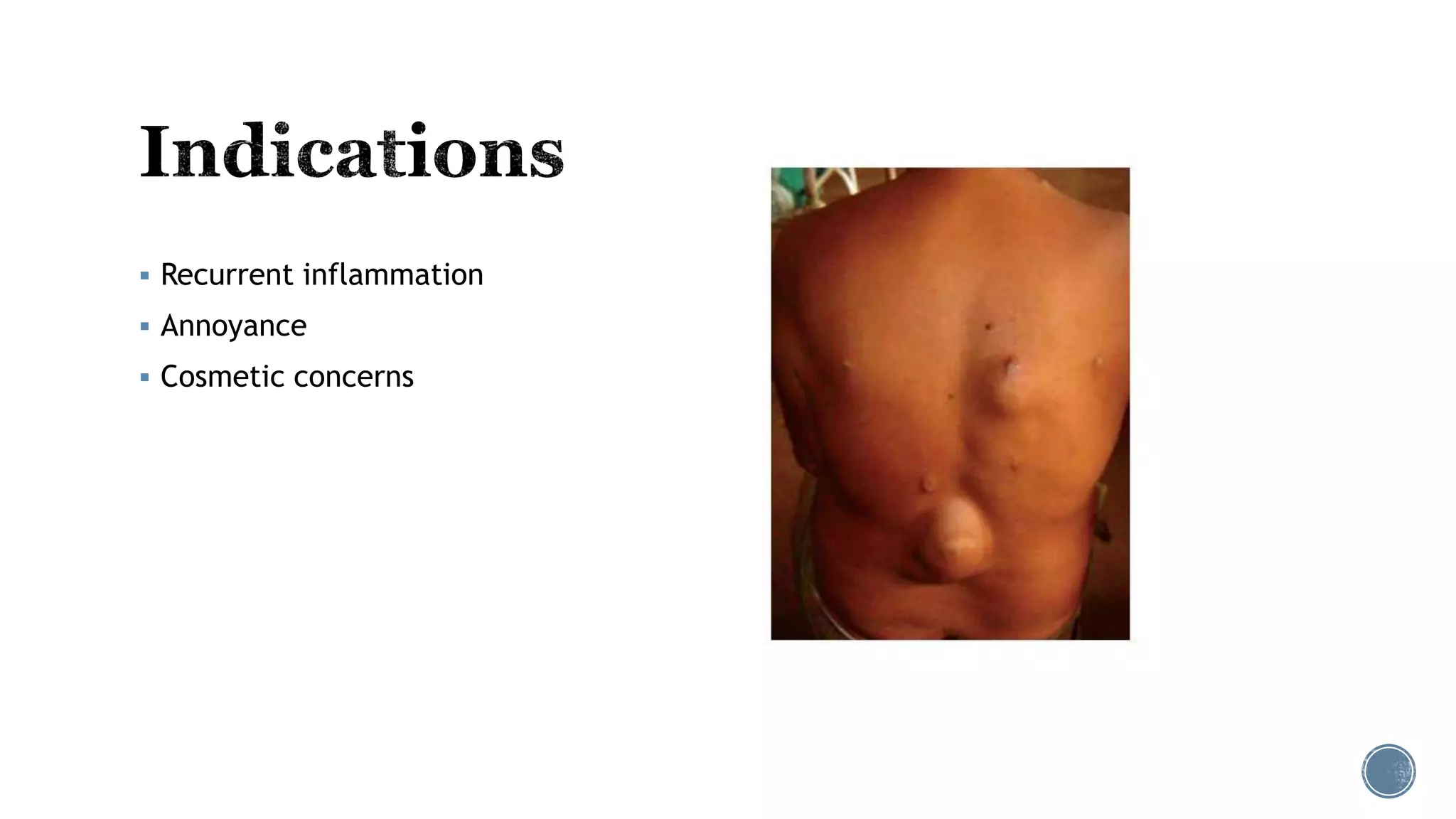OPERATIVES #01 abscess, sebaceous_cyst & LN biopsy.pptx