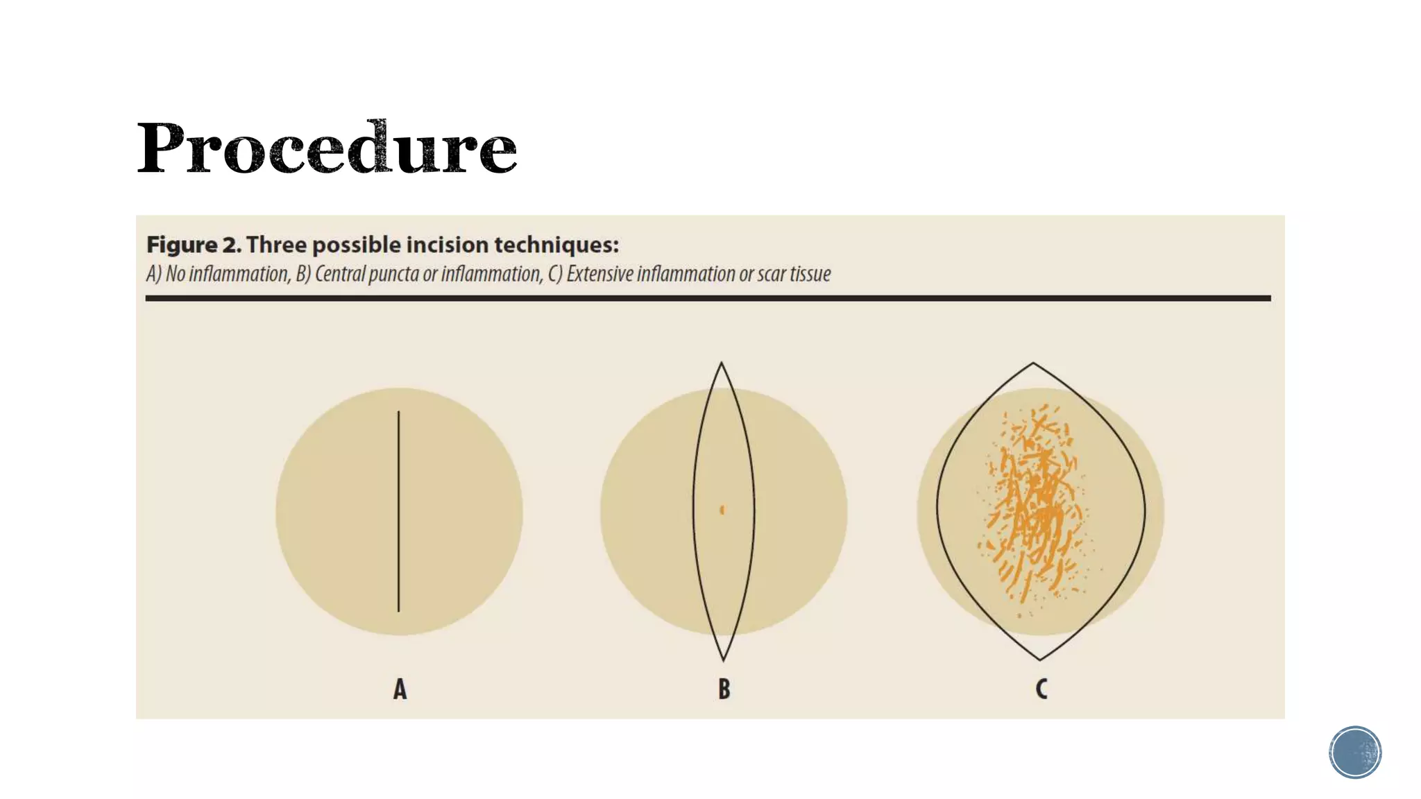OPERATIVES #01 abscess, sebaceous_cyst & LN biopsy.pptx