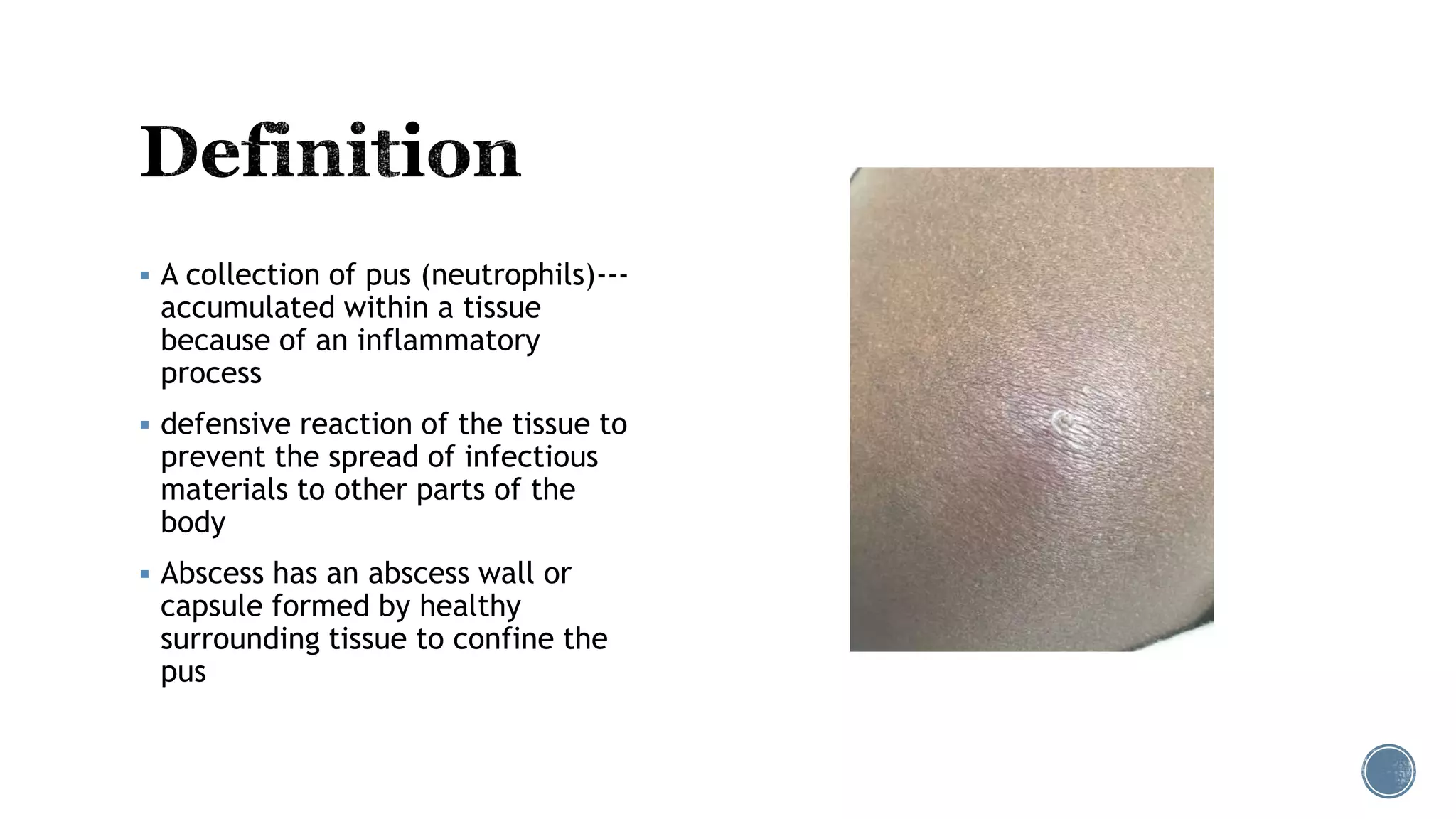 OPERATIVES #01 abscess, sebaceous_cyst & LN biopsy.pptx