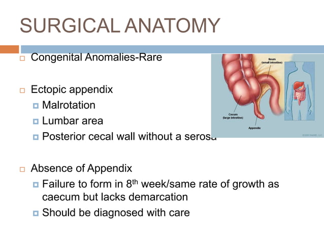 Operative steps in open appendicectomy | PPTX | Pregnancy ...