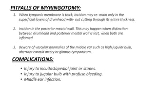 OPERATIVE SURGERIES of EAR.pptx