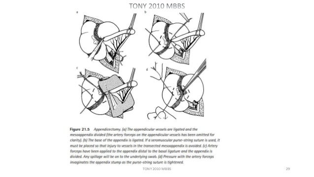 Operative surgery ppt mbbs students