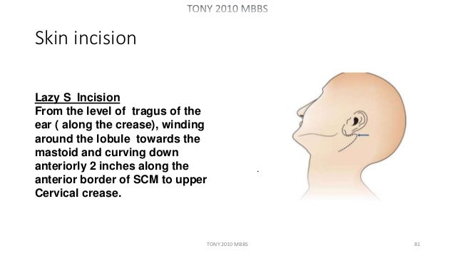 Operative surgery ppt mbbs students