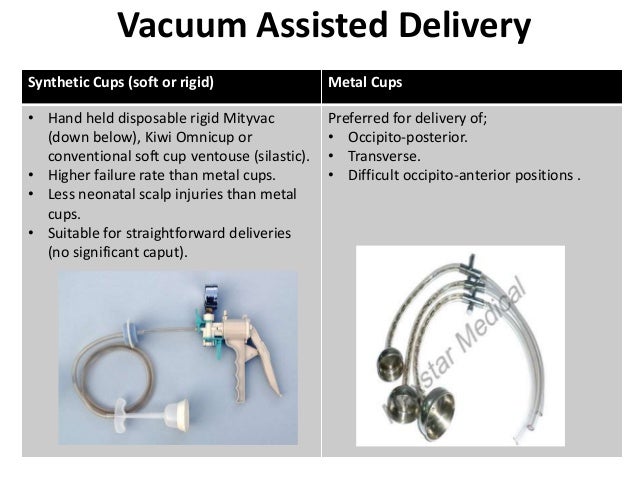 Vacuum Delivery Osce