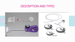 Operative vaginal delivery - forceps , vacuum delivery. | PPTX